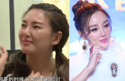 Celebrities That Went Overboard with the Botox – JayneStars.com