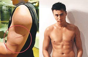 “OCTB’s” Justin Cheung Explains Why He Started Cutting Himself ...